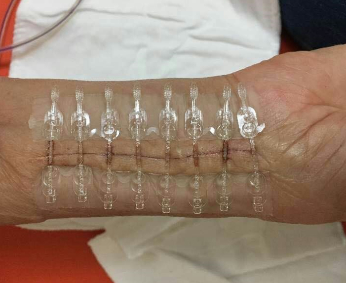 AthroSkinFix - Product no longer available - Athrohab